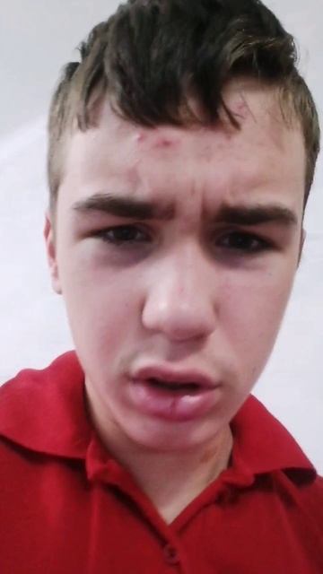 наш клоун умер 🥵🥵🤢😭😰😥😢часть 7