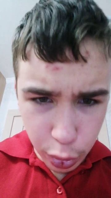 наш клоун умер 😭😭часть 8