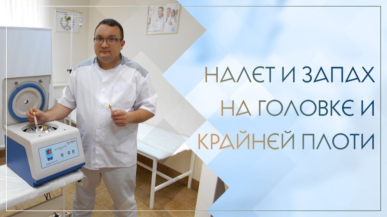 🙁 Налет и запах на головке и крайней плоти. Клинический случай №76