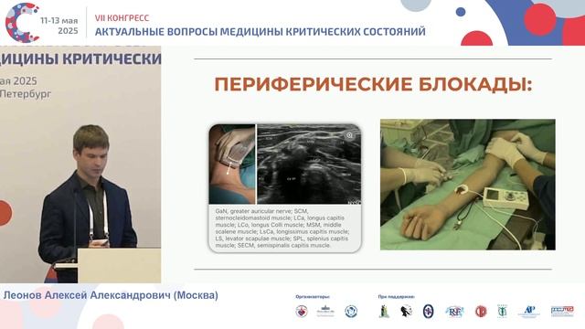 Криоанальгезия, статистический обзор нозологических форм Леонов А.А. 2025