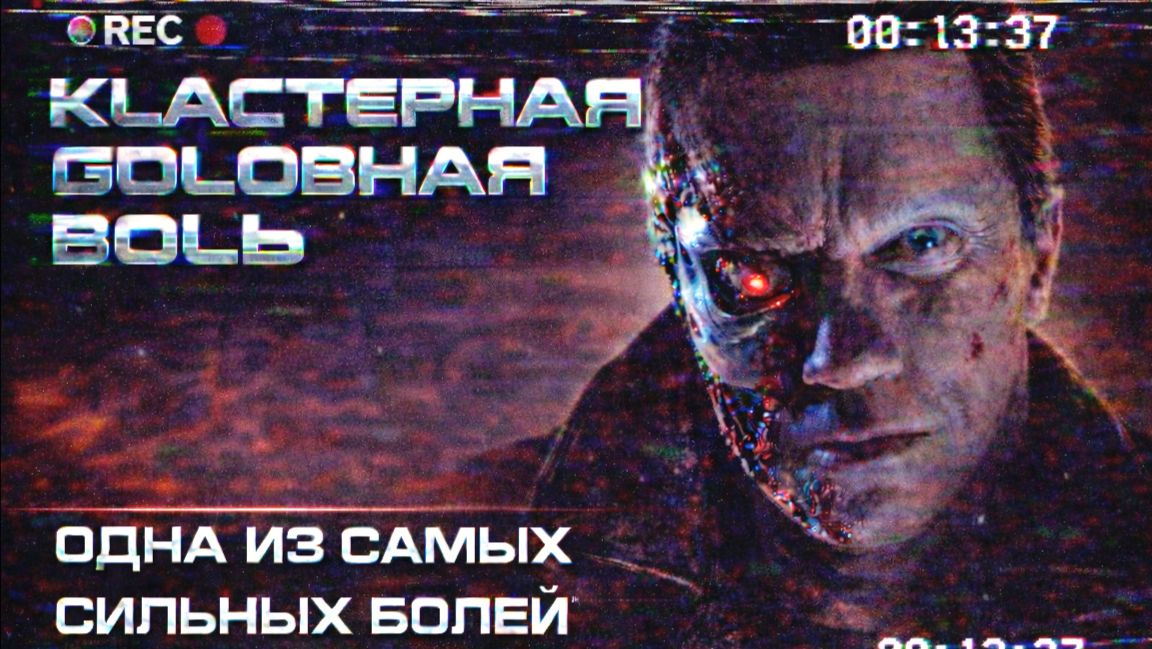 Кластерная головная боль (КГБ)