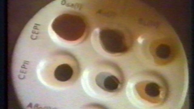 08 Форменные элементы крови (20 мин)