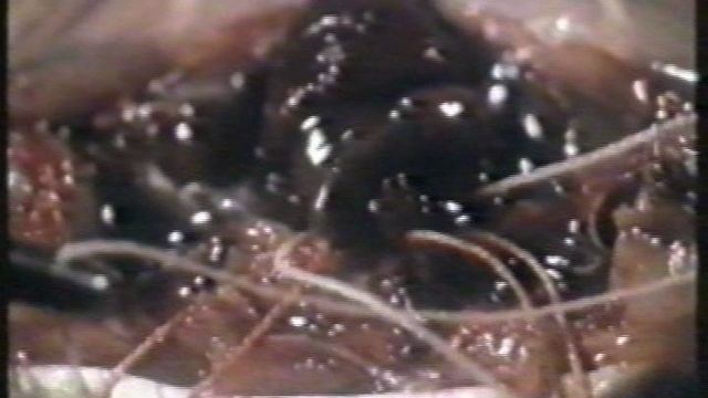 04 Приготовление препарата изолированного сердца лягушки ( 9 мин)