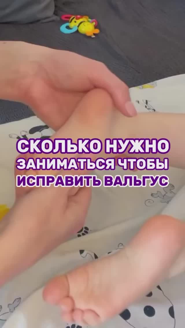 За какой срок можно вылечить вальгус?