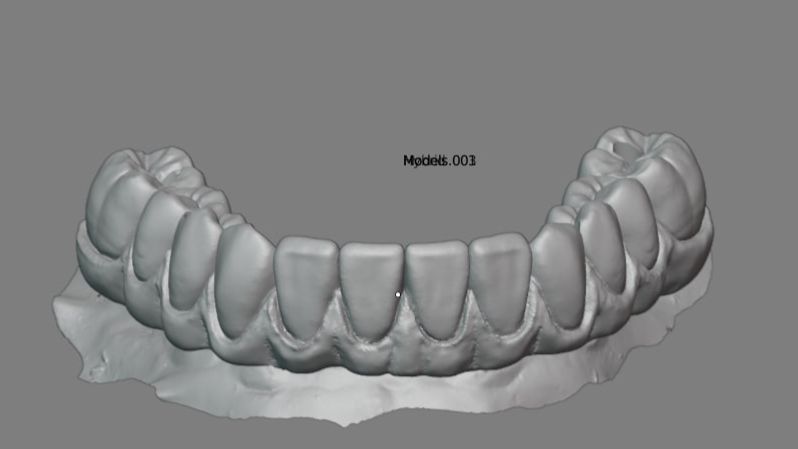Моделирование балки в B4D на имплантах (Обновленный гайд)