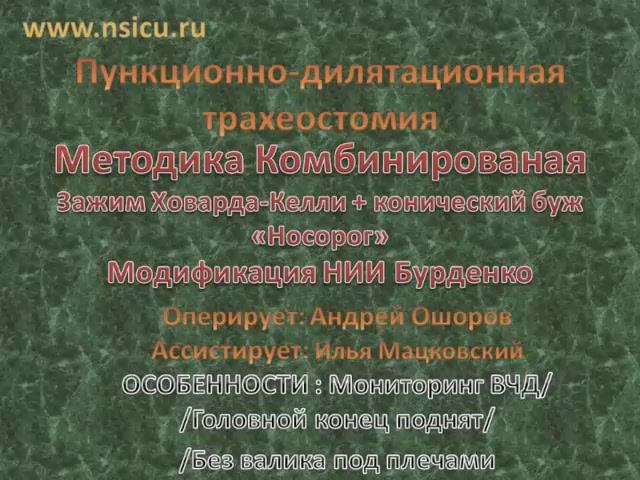 Григгз-Сигли ВЧД  (только операция)