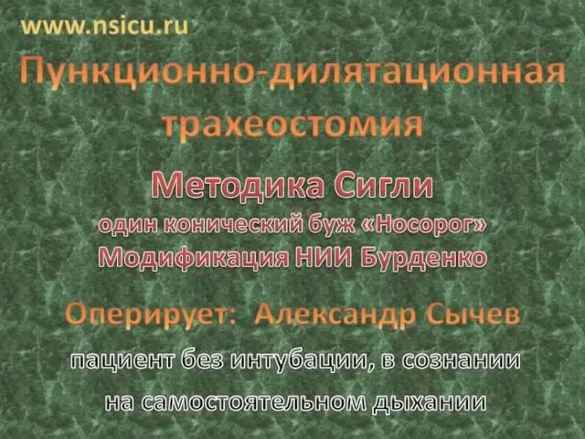ПДТ Сигли в сознании на спонтанном дыхании (7)