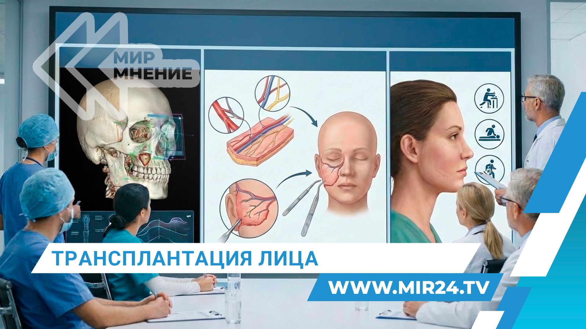 В Испании впервые пересадили лицо донора после эвтаназии: в чем уникальность операции?