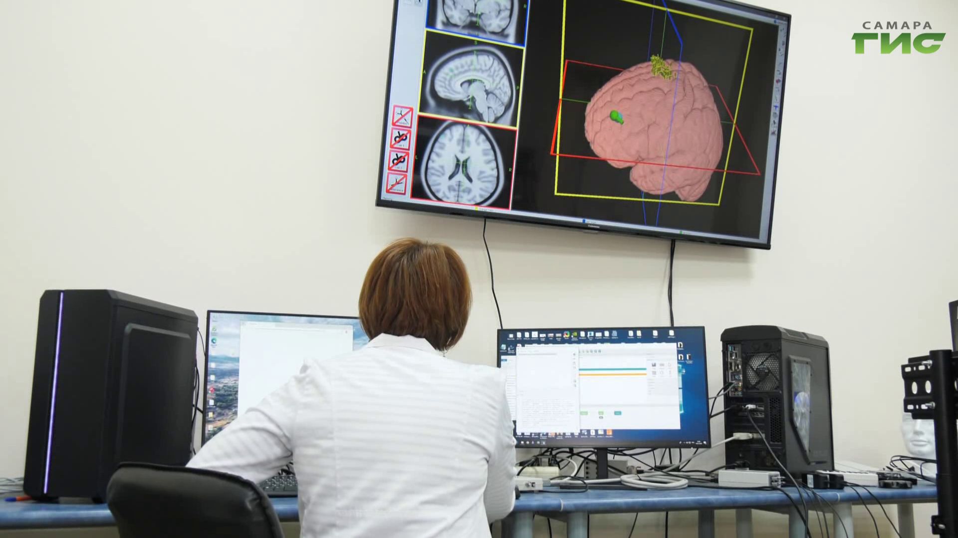 Секреты долголетия мозга: сохраняем ясность ума и память