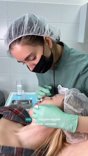 Контурная пластика: увеличение губ + коррекция морщин