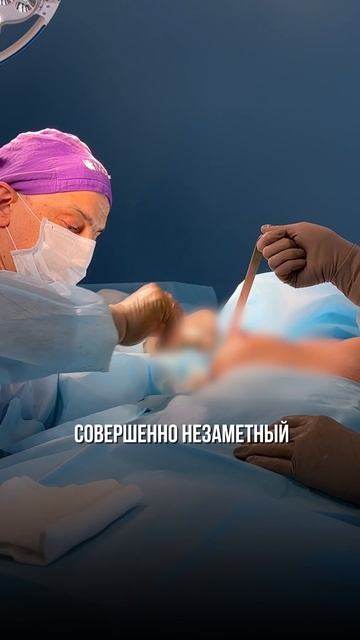 Эндоскопическое увеличение груди через подмышку