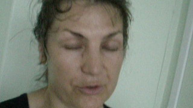 Неврология 10.07.15 г