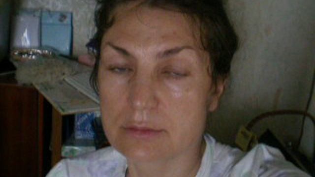 4.07.15. Опять болею.