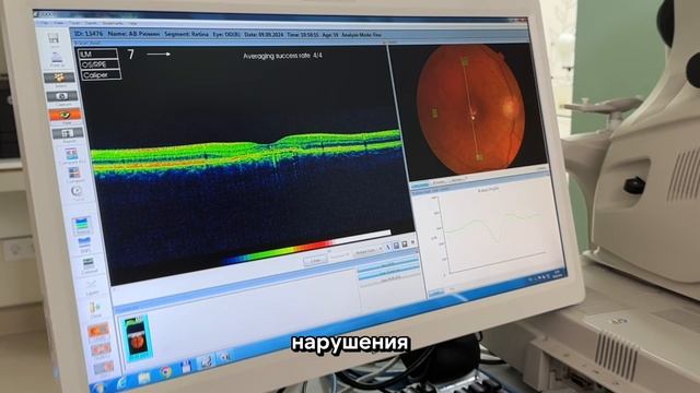 Optic Hub, приглашение