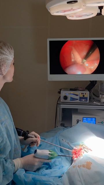 Лапароскопическая стерилизация