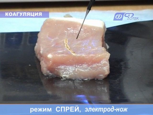 Видеоруководство по применению аппарата "ФОТЕК Е81М"