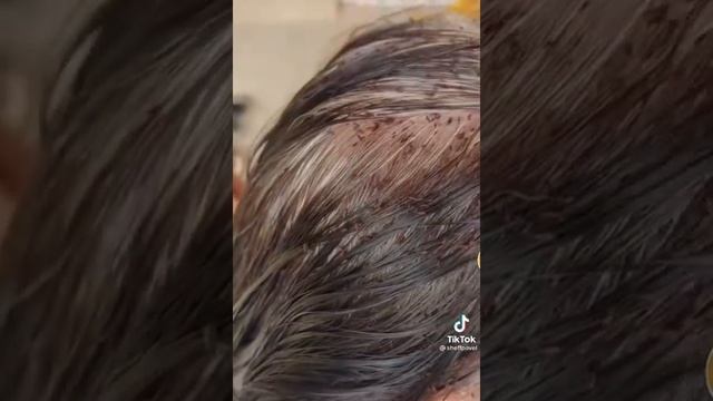 Вши съели голову