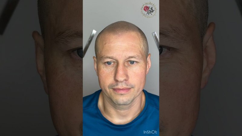 Воссоздали прическу! Тату волос, трихопигментация лучше чем пересадка Smp Scalp micropigmentation