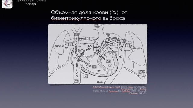 ВПС-1