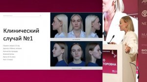 Инновационный метод терапии акне без побочных эффектов за 3 месяца. Плазмотерапия и RF-лифтинг.