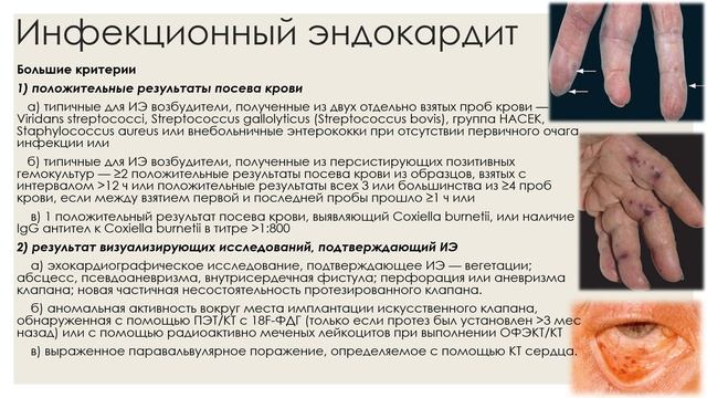9. Инфекционная патология ч3.mp4