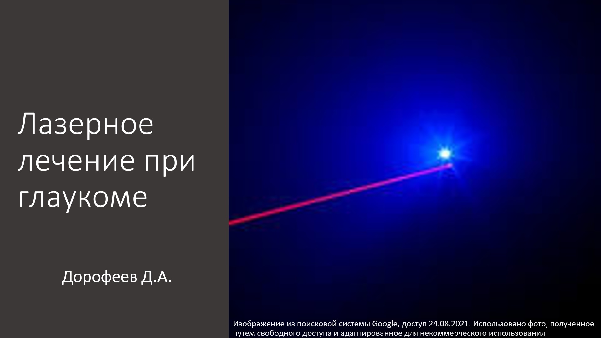 Школа глаукомы. Лазерное лечение глаукомы