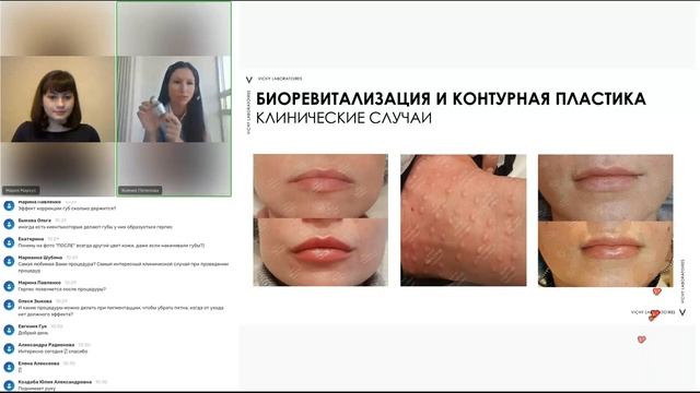 СОВРЕМЕННЫЕ МЕТОДИКИ ОМОЛОЖЕНИЯ КОЖИ.mp4
