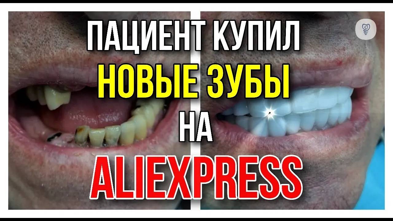 Пациент купил новые зубы на AliExpress. Имплантация зубов. Первая стоматология.