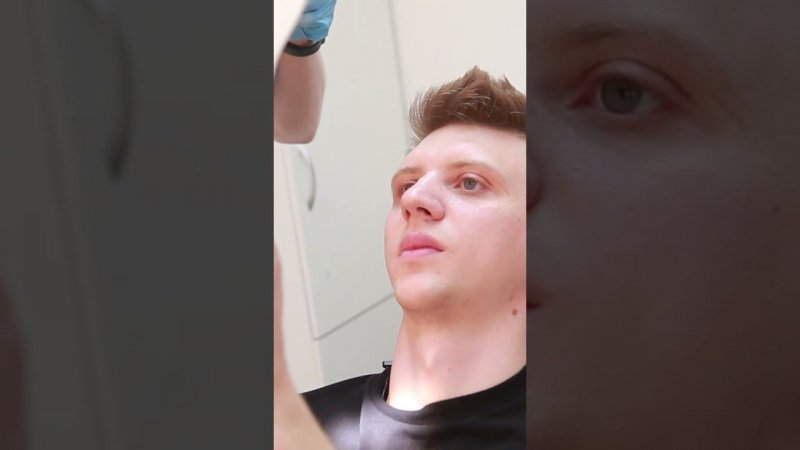 Лечение на элайнерах