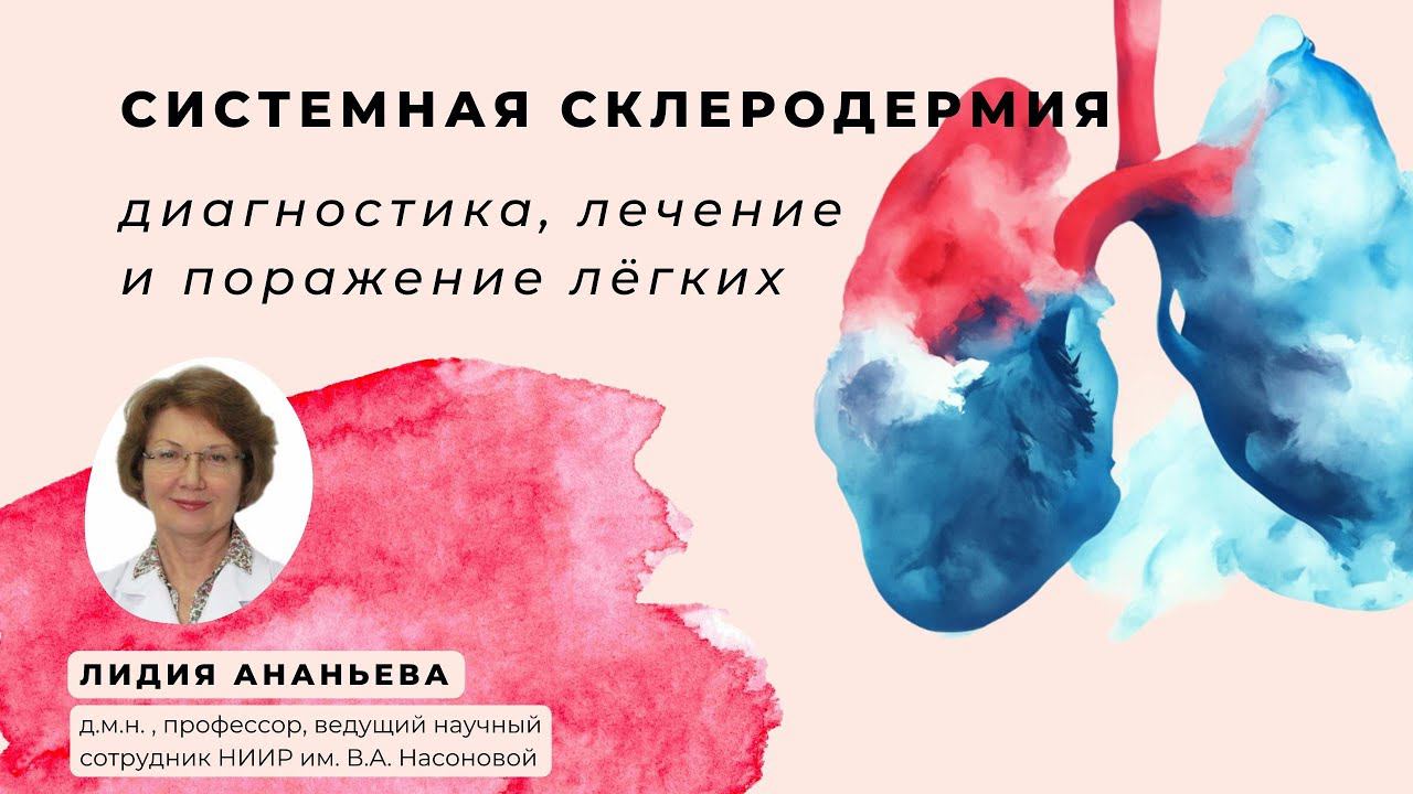 Системная склеродермия: что должен знать пациент