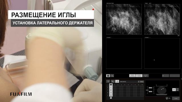 2 МС