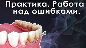 Ошибки при применении пьезо-ультразвука под десной