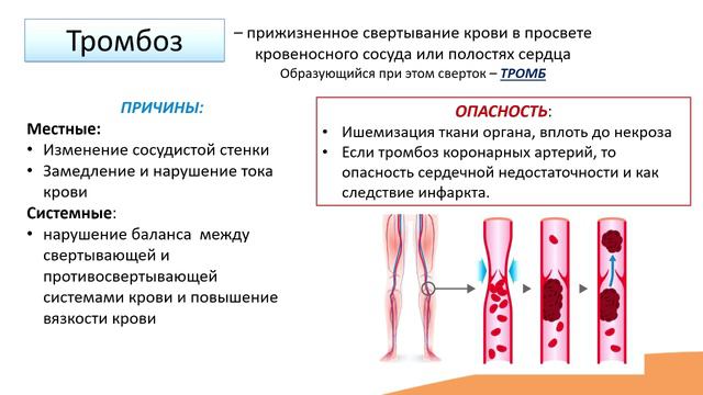 14.3. Стаз. Тромбоз. Эмболия