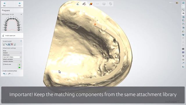 3Shape Dental System - Secondary bar design