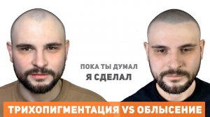 Пока ты думал - я сделал! Трихопигментация в Москве. Лучше чем пересадка Scalp Micropigmentation
