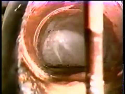 Гидродинамическа очистка промышленного трубопровода