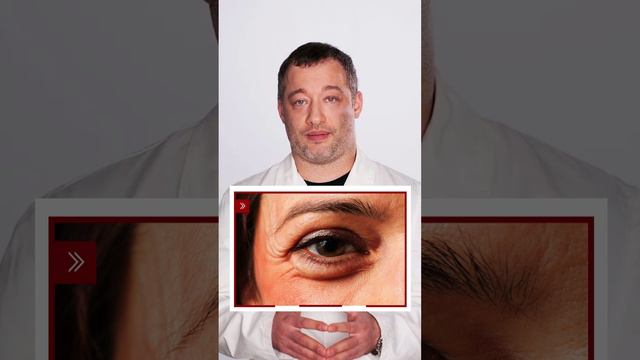 Для чего верхняя блефаропластика