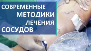 Флебология. ? Методы лечения сосудистых заболеваний в отделении флебологии Скандинавского центра.