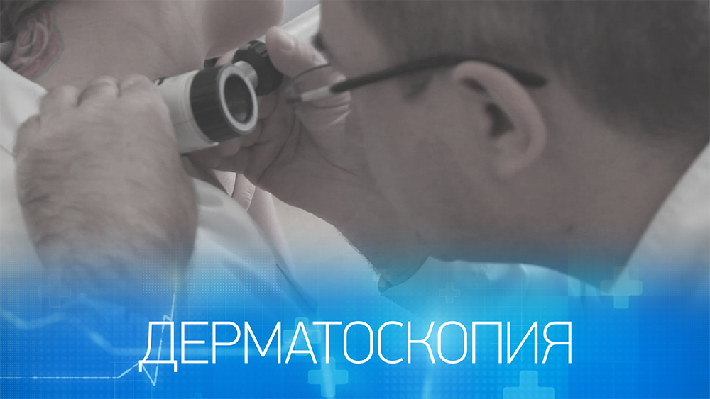 Дерматоскопия родинки