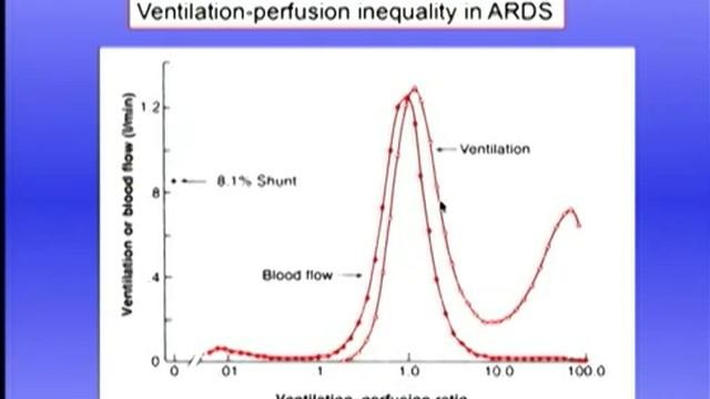 Respiratory Failure