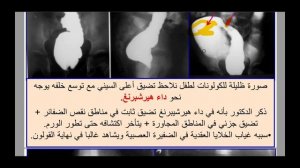 مراجعة سريعة لامتحان عملي الأشعة1 -High-yield GIT imaging (Review)