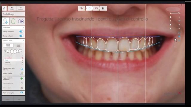 3 Shape, дизайн улыбки по-неаполитански.