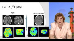 Возможности совмещенной ПЭТ и КТ: что нужно знать неврологу.  Часть 1/2.