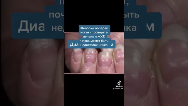 Диагнозы по ногтям