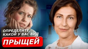 ВЫДАВЛИВАНИЕ ЭТИХ ПРЫЩЕЙ СТРОГО ЗАПРЕЩЕНО! Все, что нужно знать о прыщах: виды, лечение, причины