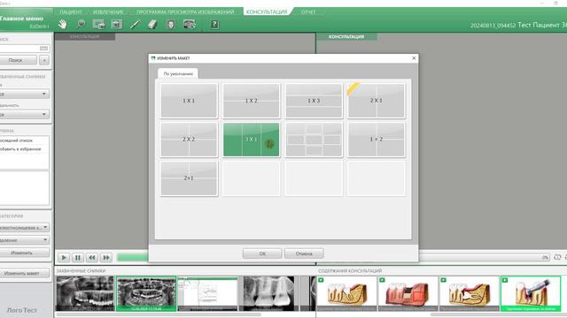 Изменение макета консультации