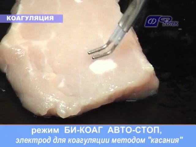 Демонстрация режима: "БиКоаг Автостоп"