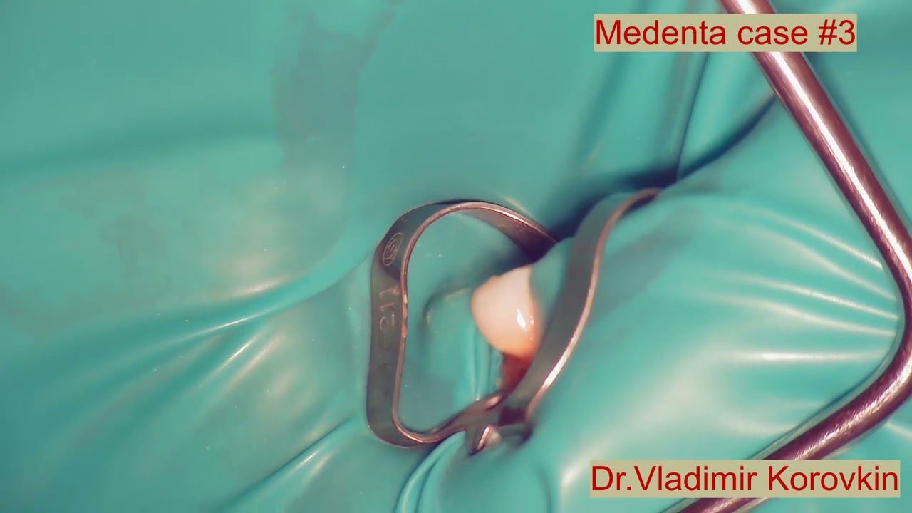 Кейс раббердам Medenta. Для изоляции 45.  V класс . кейс #3.