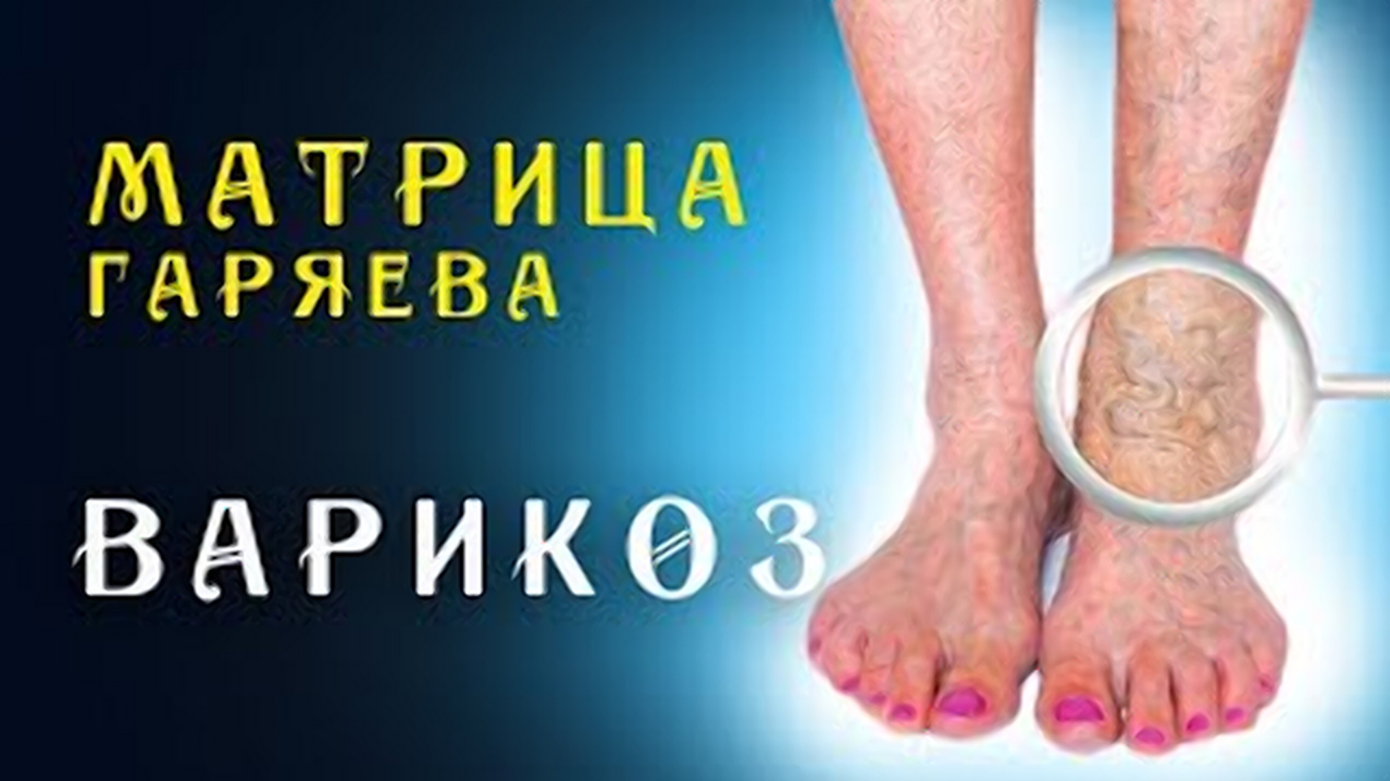 Очень мощная матрица Гаряева от варикоза ☀️ SoftRadio.ru - смотреть видео онлайн от «SoftRadio ...