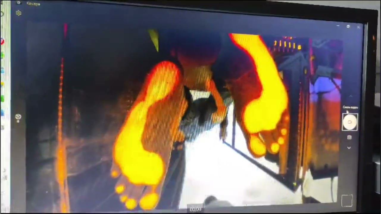 Компьютерный подоскоп (плантоскоп, плантограф, плантоскан)